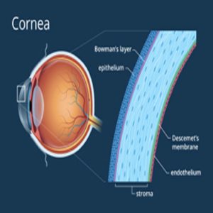 Cornea and External Diseases – Ambaye Eye Care