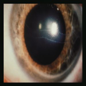 Cornea and External Diseases – Ambaye Eye Care